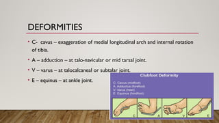 Congenital talipes equino varus Presentation (4).pptx