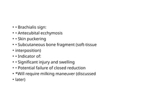 Paediatric supracondylar fractures of humerus | PPT