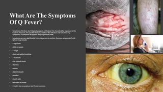 Q FEVER | PPT