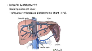portal hypertension.pdf