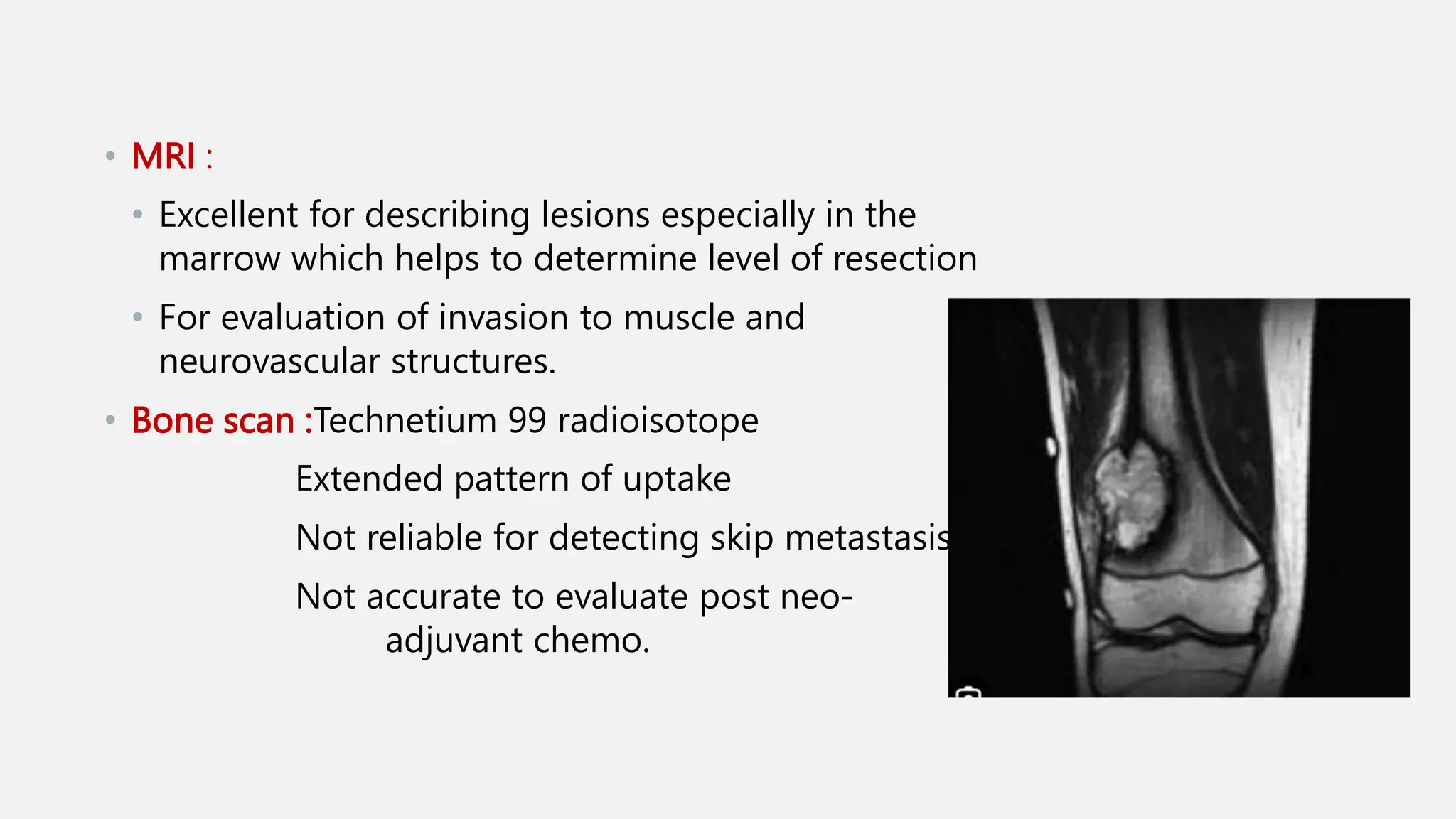 Presentation (4) (3).pptx Malignant bone tumours presentation ...