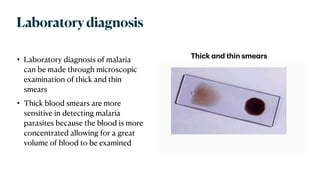 Diagnosis tests and treatment of malaria | PDF
