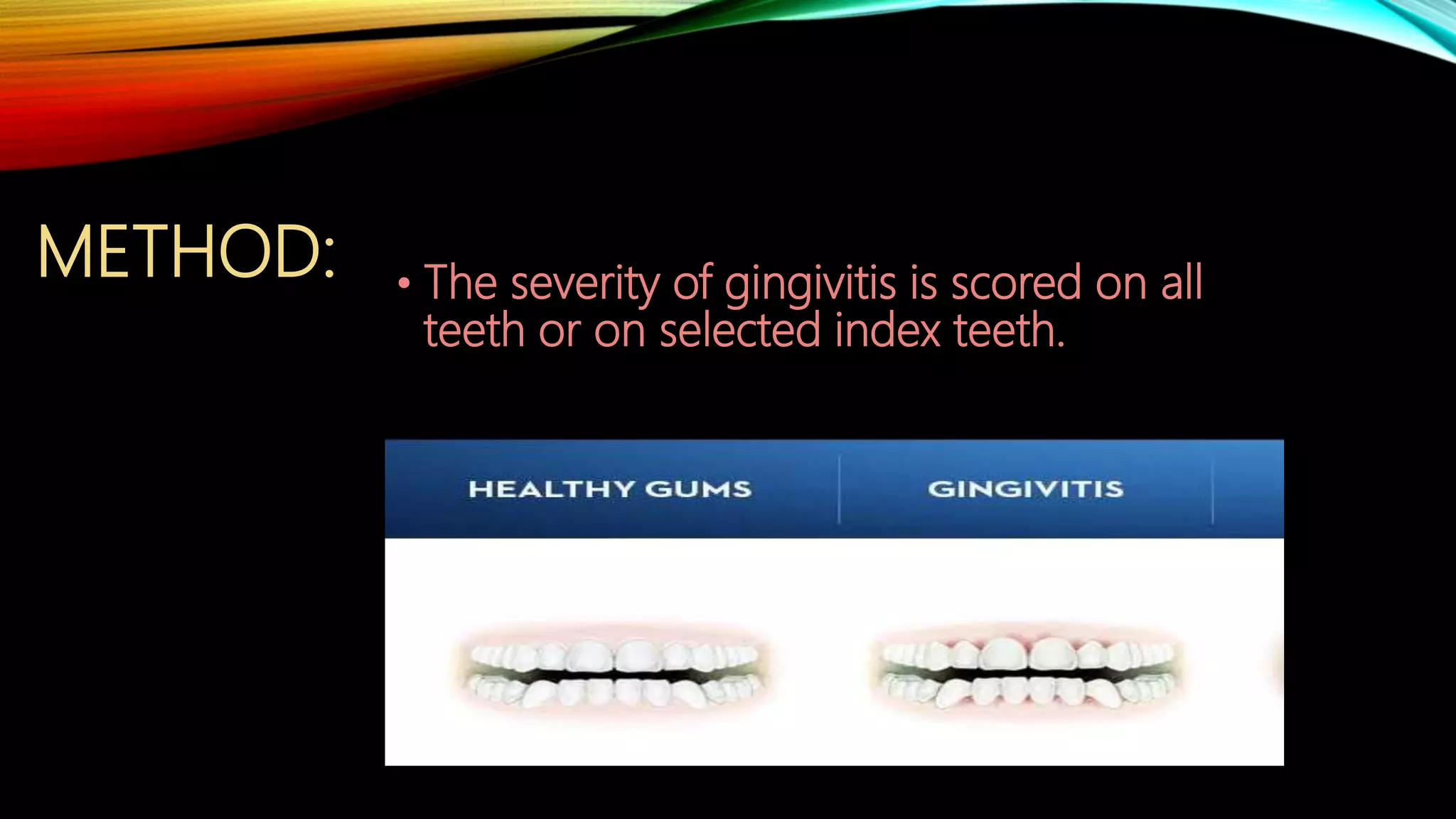 indices of gingival diseases | PPTX