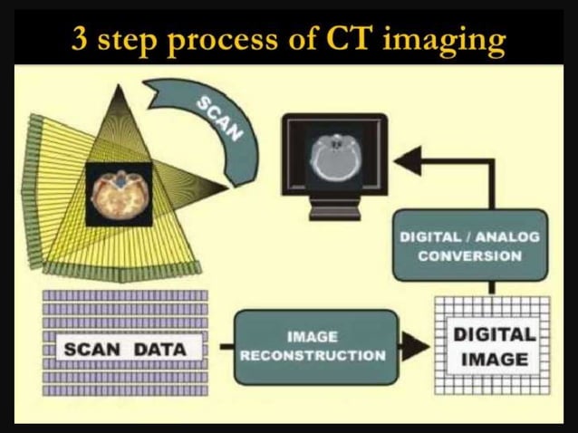 Presentation4, ct and mri basics. | PPTX | Medical Tests | Medical Health