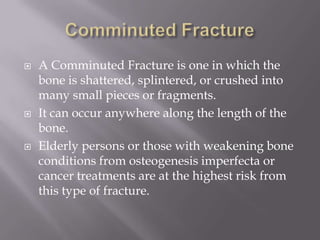 Presentation 4 fractures | PPT