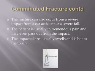 Presentation 4 fractures | PPT