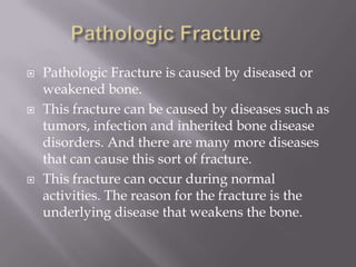 Presentation 4 fractures | PPT