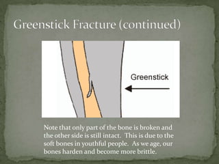 Presentation4 musculoskeletal fractures | PPT