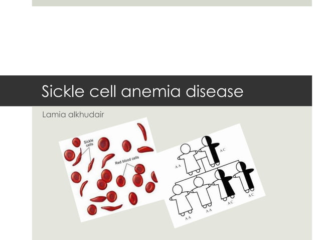 sickle cell anemia | PPT