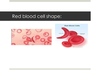 sickle cell anemia | PPTX