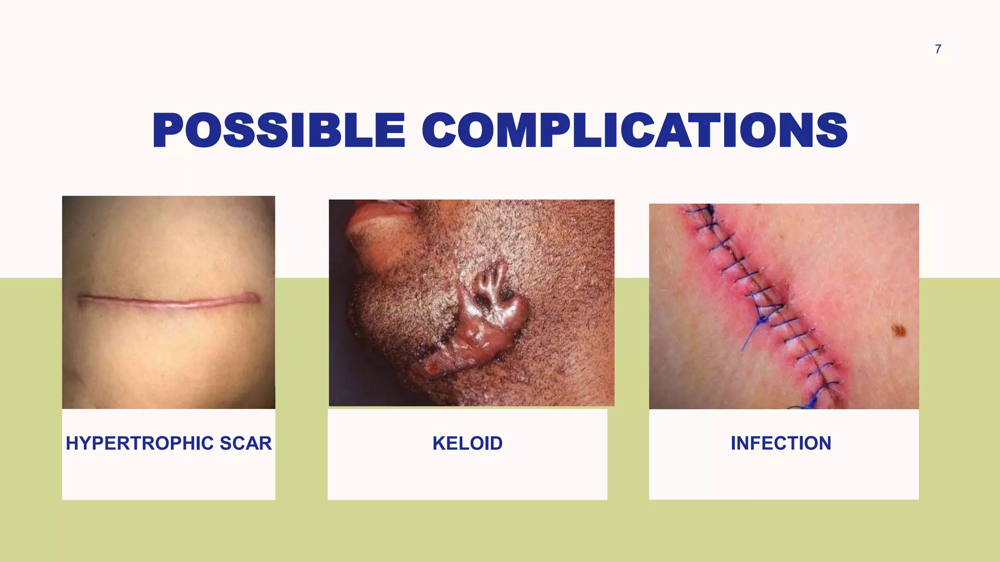 Suture Removal-Stitch Out Protocol | PPT