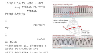 ANTI ARRHYTHMIC DRUGS and action potential correlation | PPT
