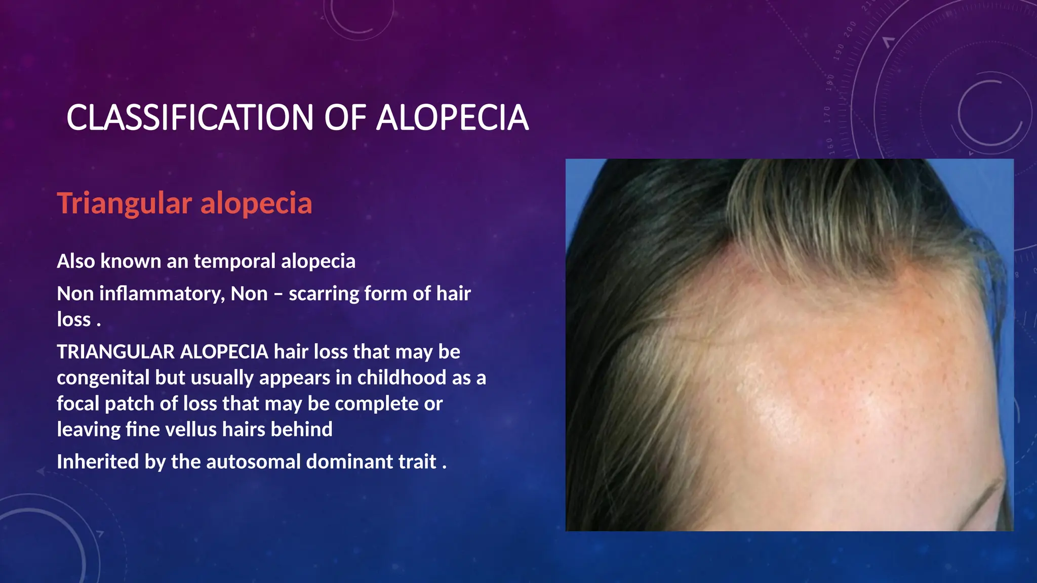 Presentation on alopecia nursing (5).pptx