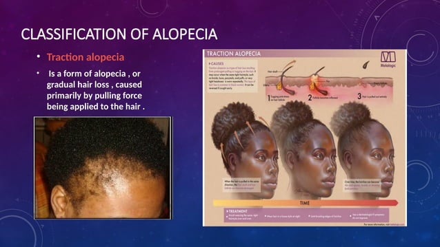 Presentation on alopecia nursing (5).pptx