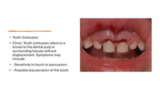 Presentation 5 - Copy - Copy.pdfvvvvvvvcddd | PPT