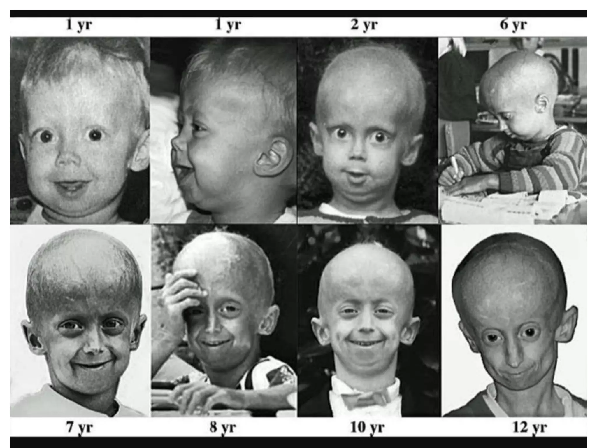 ppt 5 dr.kd [nursing]ashish rao | PPT