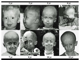 ppt 5 dr.kd [nursing]ashish rao | PPT