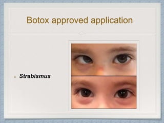 Botox | PPTX