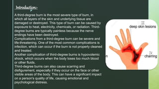 Stem cell in burn treatment | PPT