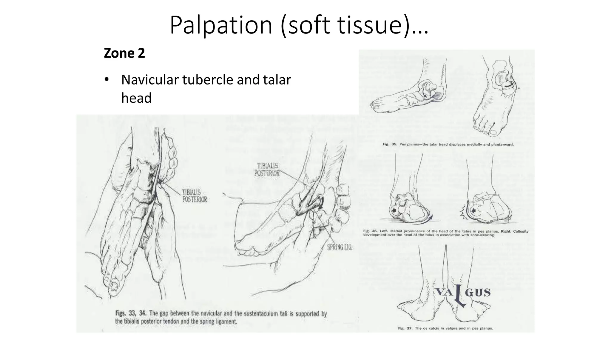 Presentation6 foot 6.pptx
