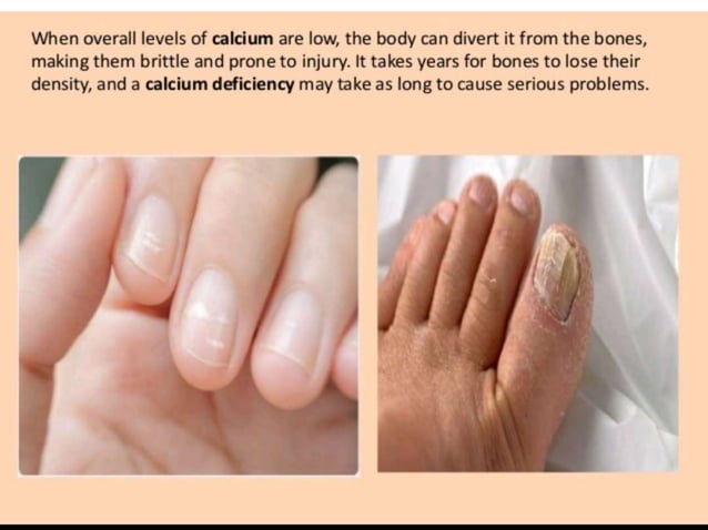 ppt 6 dr.kd rao[nursing biochem] | PPT