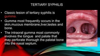 Oral manifestation of syphilis | PPTX