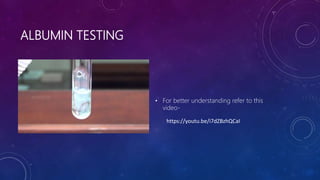 Urine Testing for Detection of presence of glucose and proteins | PPTX