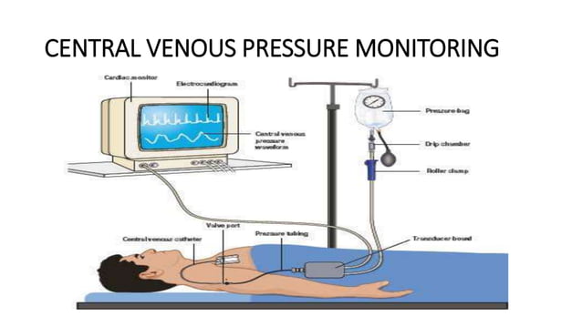 BASIC ANAESTHETIC MONITORING | PPTX