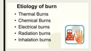 BURN IN AHN including definition, stages, etiology, clinical ...
