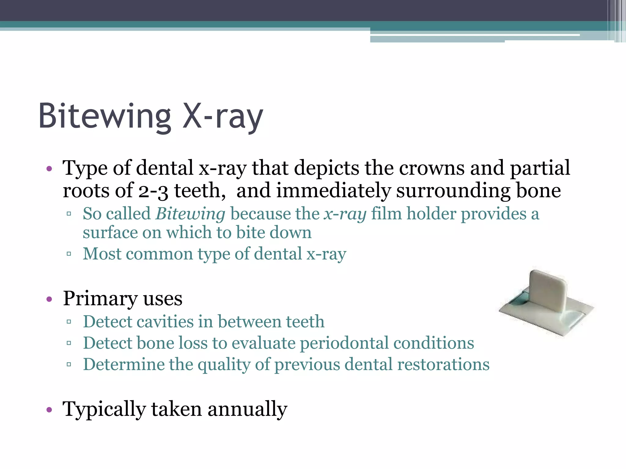 Presentation8: colonsocopy, bitewing x-ray, hernioplasty, anastomosis ...
