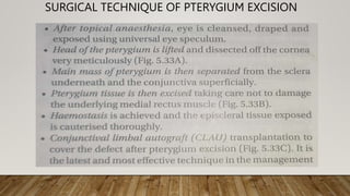Presentation (8). Ppt on topic of ophthalmology | PPT