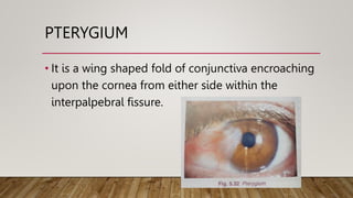 Presentation (8). Ppt on topic of ophthalmology | PPT
