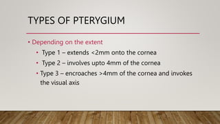 Presentation (8). Ppt on topic of ophthalmology | PPT