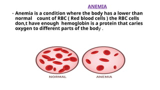 Anemia and their types & in short defination and symptoms &treatment | PPTX