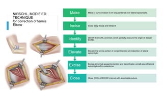 Surgical management of tennis elbow | PPTX | Death, Injury, or Military ...