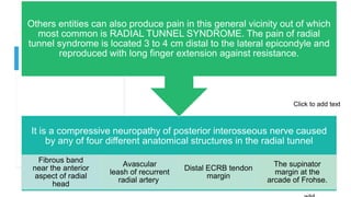 Surgical management of tennis elbow | PPTX