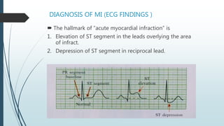 Use of ECG in myocardial infarction | PPTX