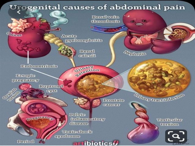 Presentation 8 kd dr.ashish rao | PPT