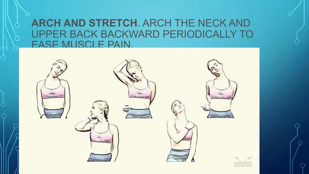 text neck deformity | PPT