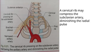 Subclavian artery and it's branches and clinical anatomy | PPTX