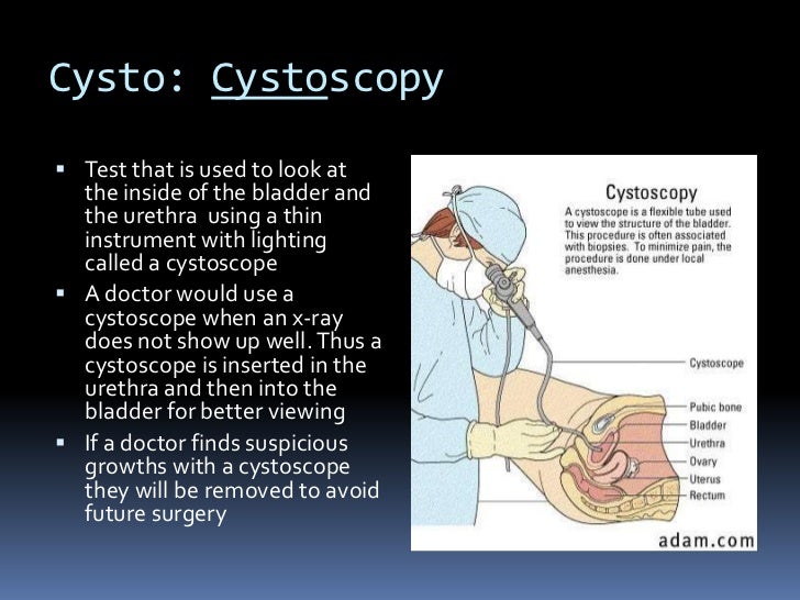 Presentation 9 anatomy and physiology of the urinary system abbrevi…