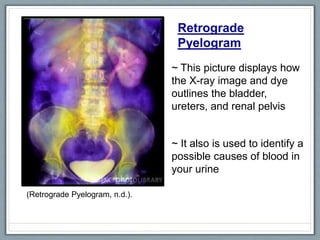 Presentation 9 urinary system | PPTX