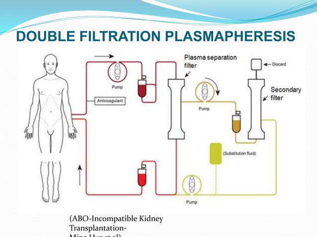ABOi titers Methodology and Interpretation | PPTX | Blood Disorders ...
