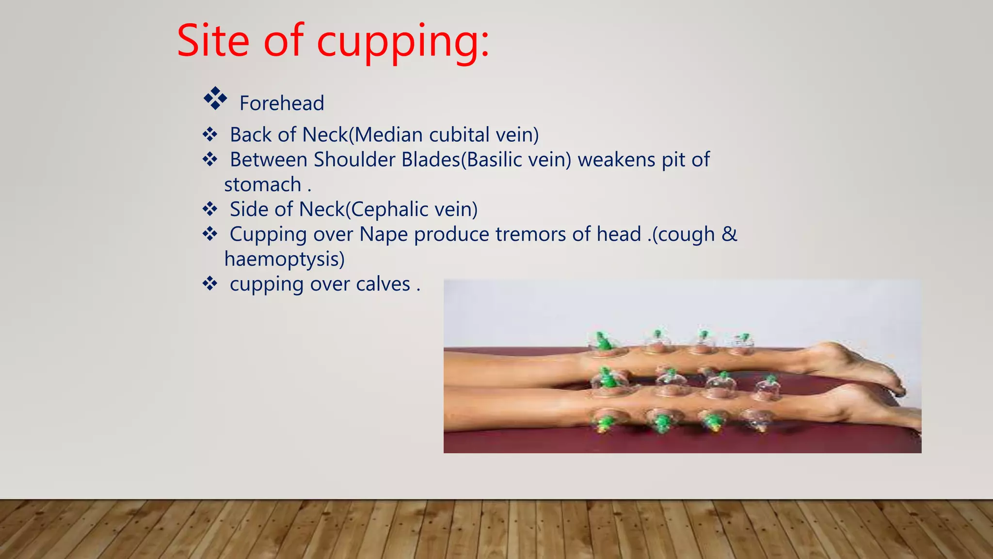 Presentation about cupping | PPTX
