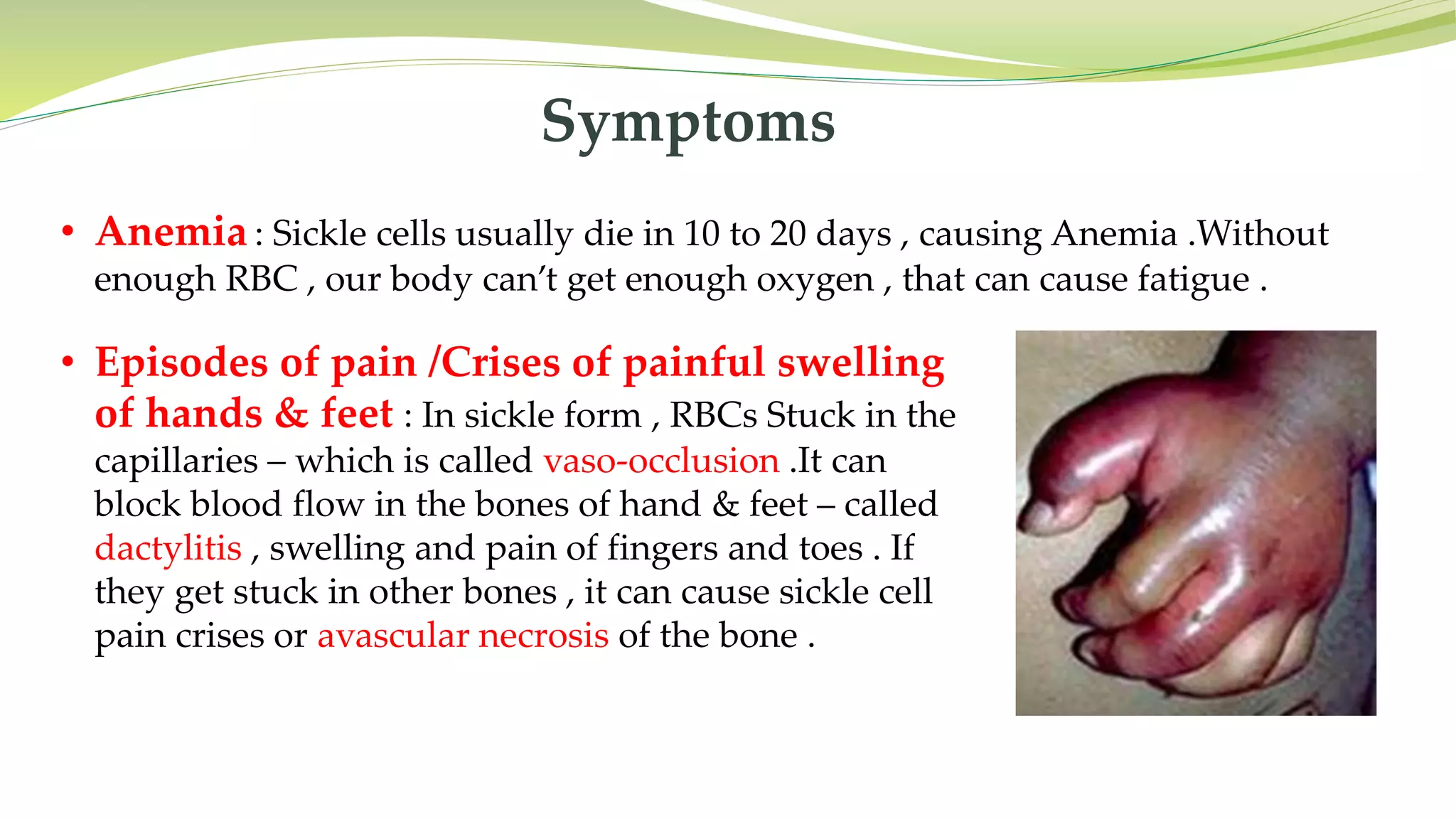 Presentation about sickle_cell_anemia_ | PPTX