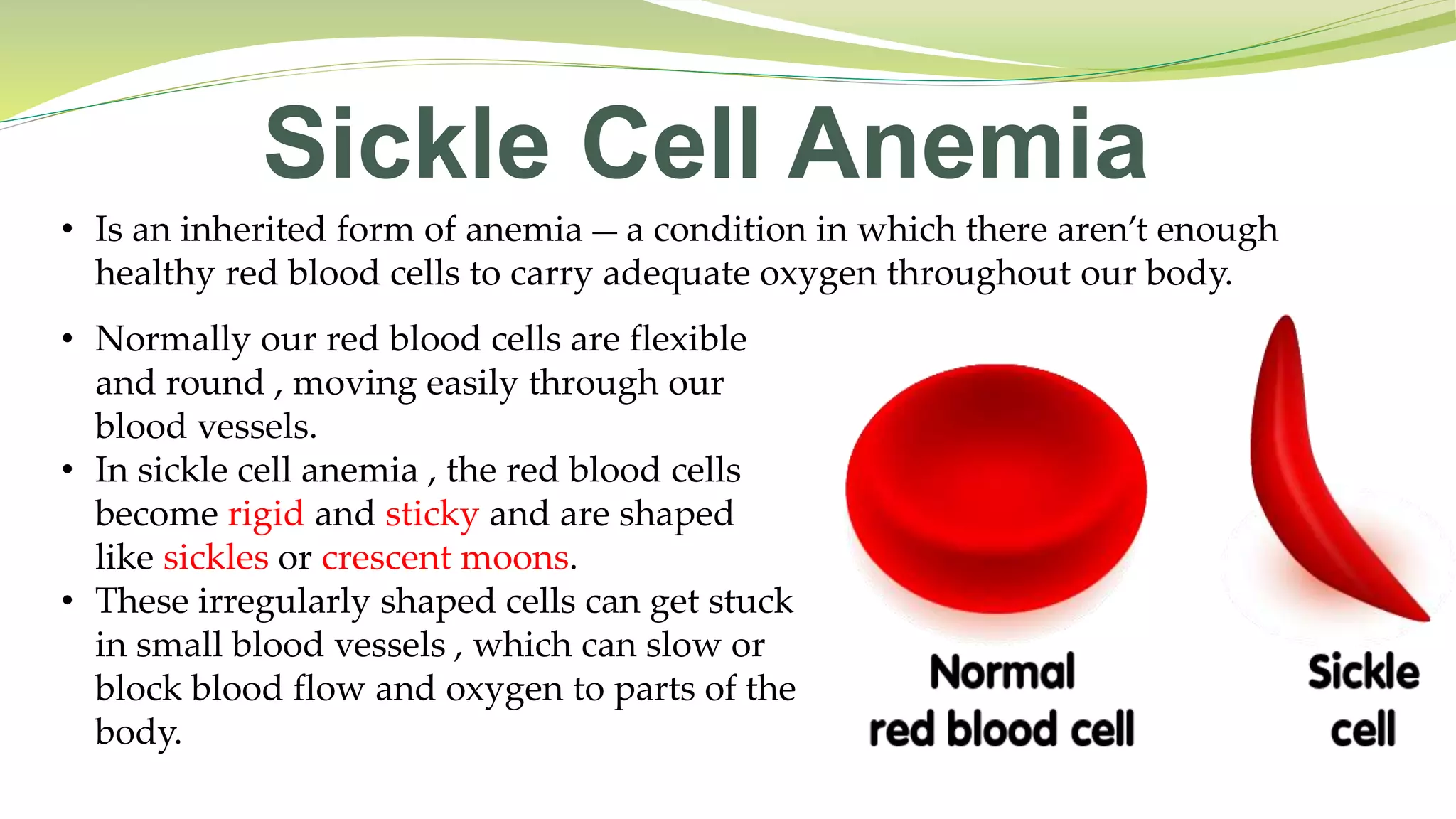 Presentation about sickle_cell_anemia_ | PPTX