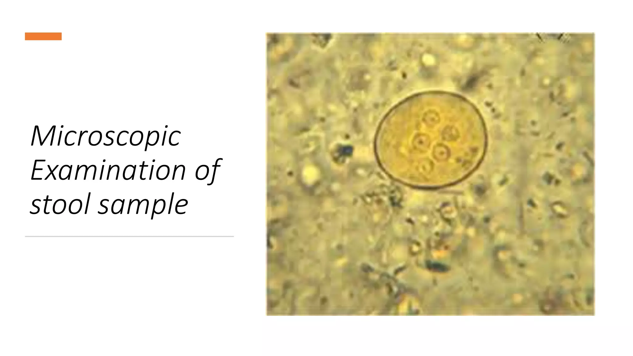 Amebiasis And Future Perspective Pptx