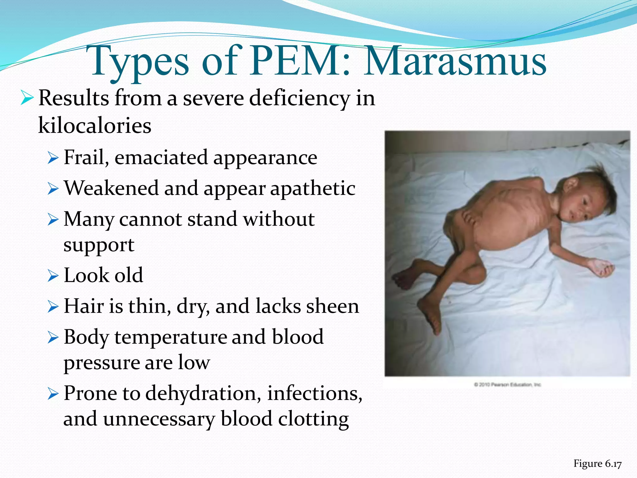 Amino acid & Proteins | PPTX
