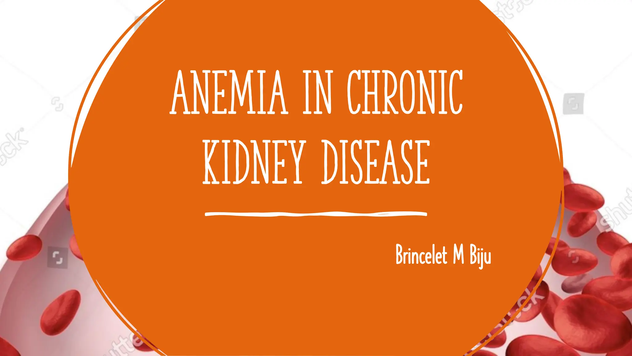 ANEMIA IN CHRONIC KIDNEY DISEASE,NEPHROLOGY | PDF