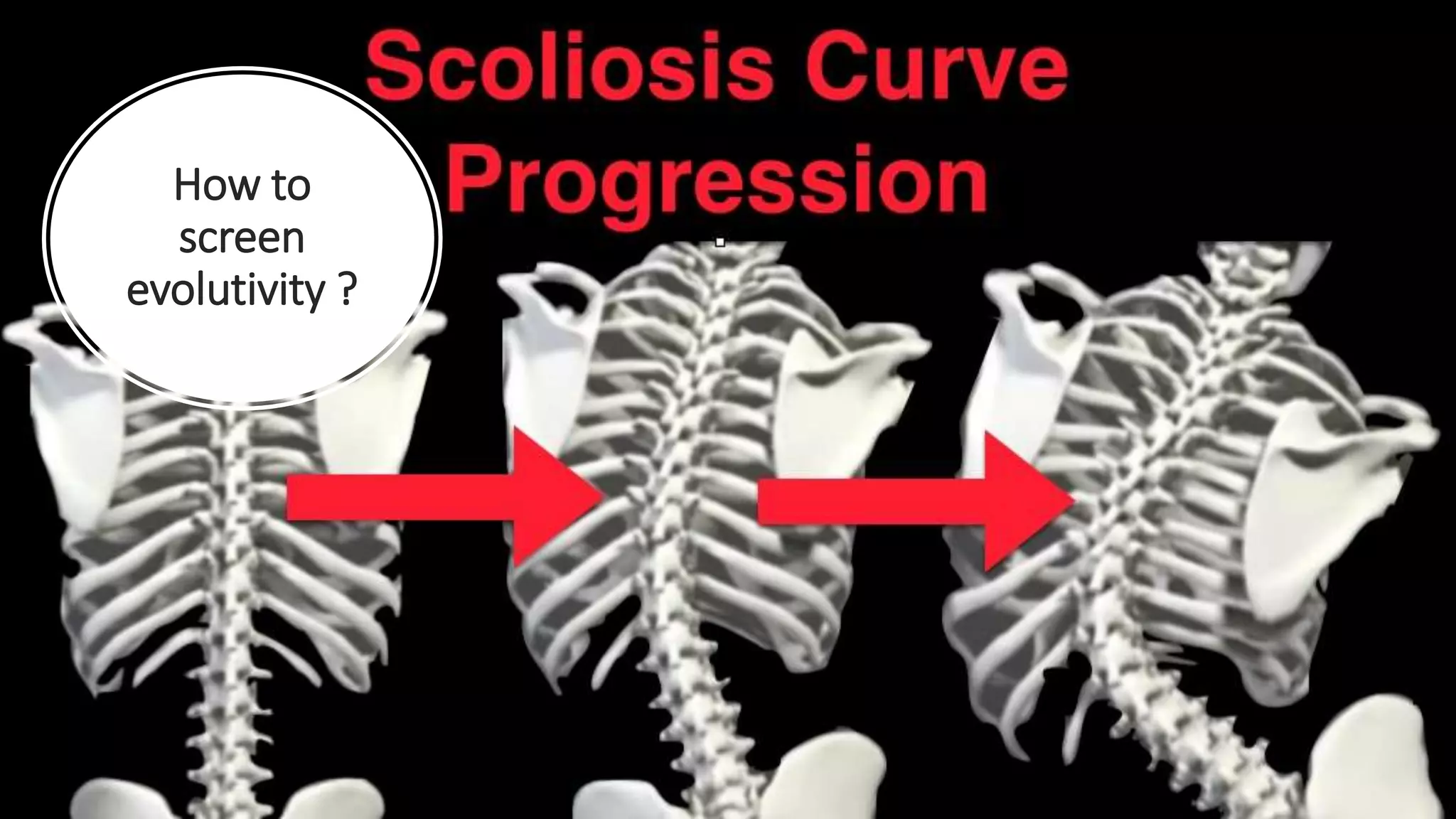 Digitized manual palpation: a new method of evaluating posture and its ...